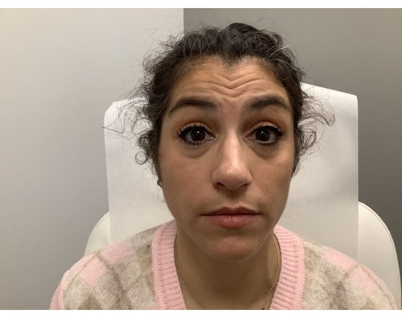 Using Injectable Botulinum Toxins (Botox) for TMJ & Facial Contouring ...